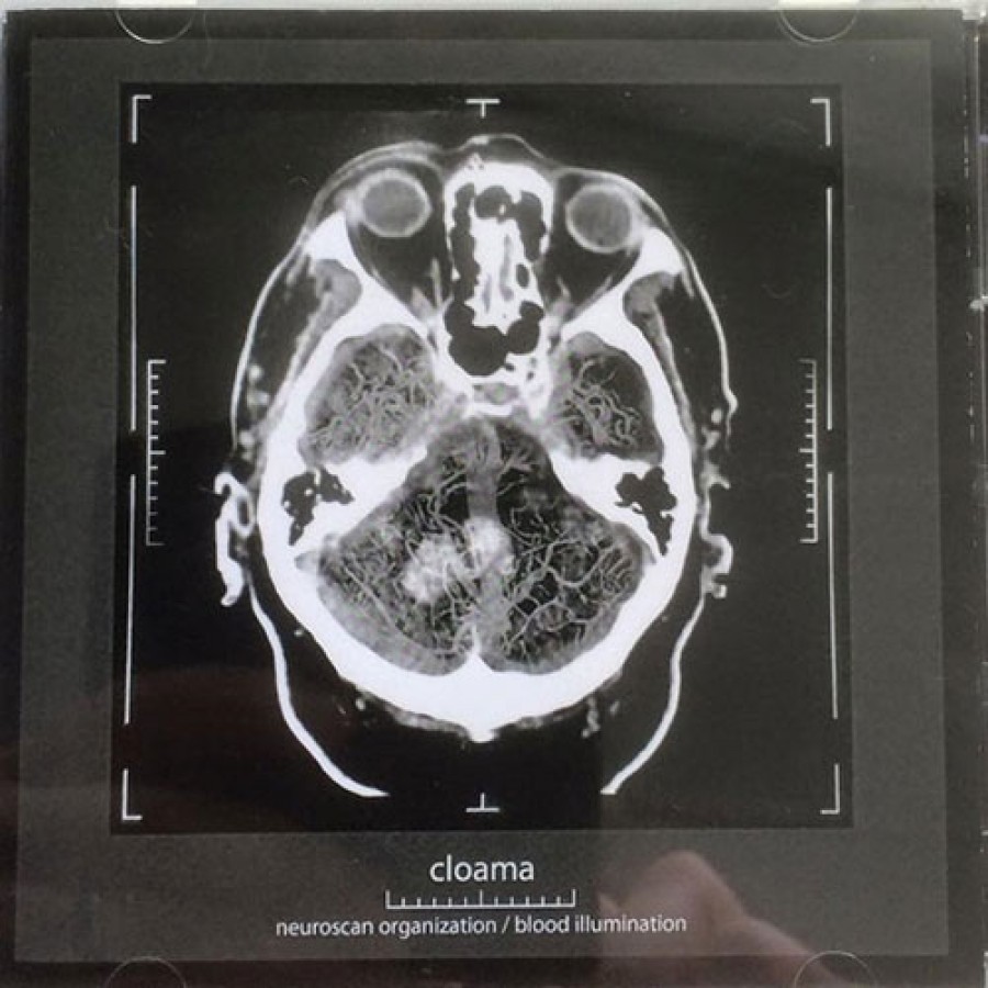 cloama Neuroscan Organization Blood Illumination